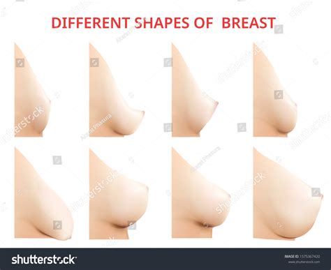 Types Of Breast Shapes Real Pics Breast Implant Types Silicone Or