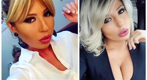 ეს შეშუპებაც მიქრება და მერე ვეღარ იტყვით ცარიელი ტრაკ ო როგორ