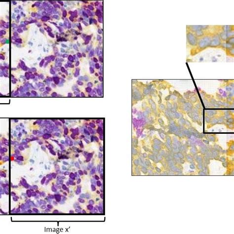 Right Tiling Effect In Adjacent Output Tiles Left Image X And X Download Scientific