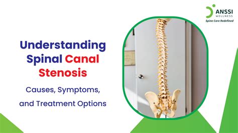 Spinal Canal Stenosis Causes Symptoms And Treatment Options