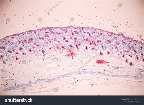 Scalp Hair Follicles Human Under Microscope Stock Photo 2163177341 Shutterstock