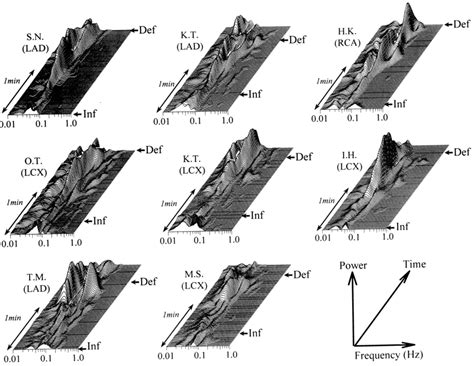 Three Dimensional Continuous Plots Wavelet Transforms Of Rr Interval Download Scientific