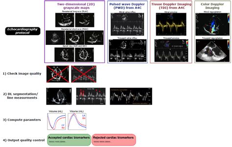 Ai Enabled Assessment Of Cardiac Function From Echocardiography Epsrc Cdt In Smart Medical Imaging