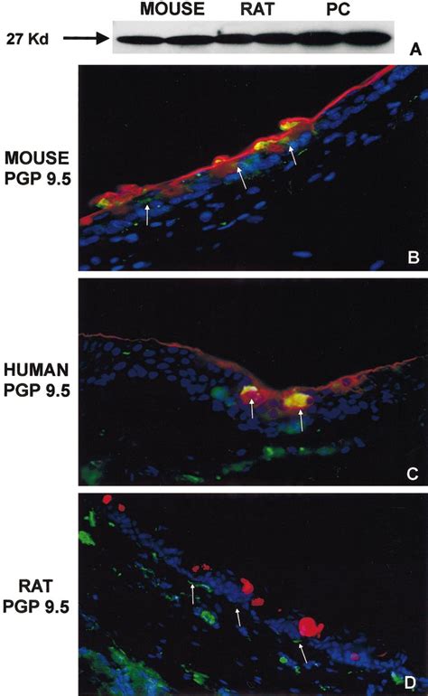 Immunolocalization Of Pgp 9 5 A General Marker For Nerves In Mouse Download Scientific