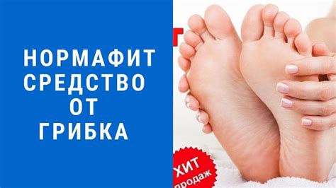 недорогое средство от грибка ногтей - uniformcustomize