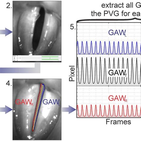 Segmentation Process 1 Selection Of The Glottis Region 2 Selection Download Scientific