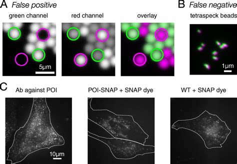 Designing A Rigorous Microscopy Experiment Validating Methods And Avoiding Bias Pmc