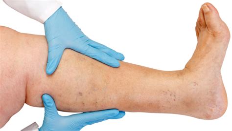 How To Recognise The Signs Of Pad
