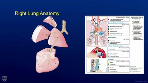 Blackmon Vats Rul S3 Segmentectomy Youtube