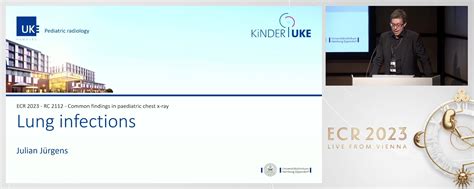 Common Findings In Paediatric Chest X Ray Cxr Esr Connect