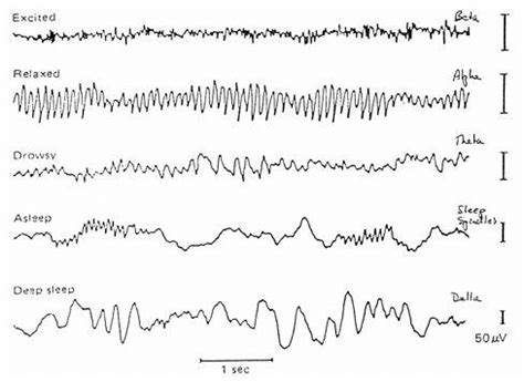 EEG Wave Frequency Ranges Download Scientific Diagram