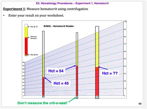 Measuring Hematocrit Diagram Quizlet