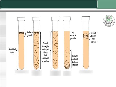 Aerobic And Anaerobic Bacteria In Broth Diagram Quizlet