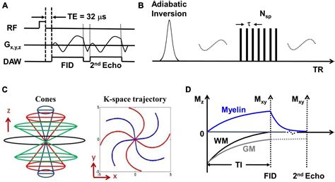 The Signal Intensity Variation Of Multiple Sclerosis Ms Lesions On Magnetic Resonance Imaging
