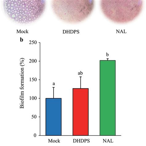 sequence alignment of different bacterial dhdpss and nals sequences of
