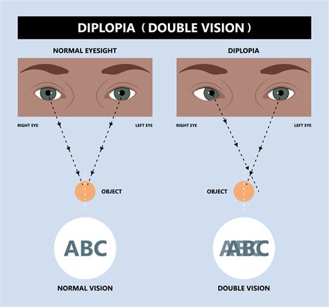 Visual Requirements For Driving