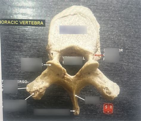 Thoracic Vertebra Diagram Quizlet