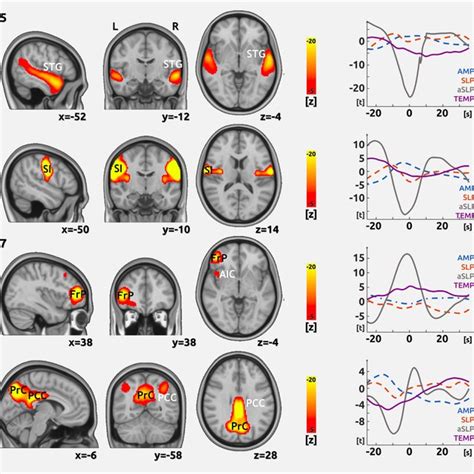 Encoding Of The Applied Temperature The Figure Shows Intrinsic Download Scientific Diagram