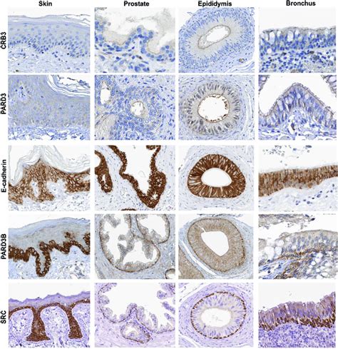 Pard3b Overlaps With E Cadherin And Src In Basal Layer Cells Of Various Download Scientific