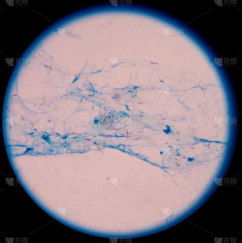 结核分枝杆菌是我国的一种致病菌