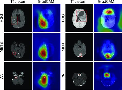 Coarse Attention Maps Generated By Using Gradient Weighted Class Download Scientific Diagram