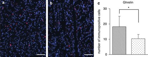 Distribution Pattern And Localization Of Ghrelin Immunoreactive Cells