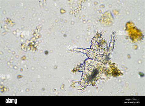 Fungi Under Light Microscope