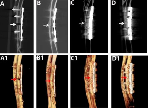 Micro Ct Assessment Of The Healing Process Of Rabbit Ulnar Fractures In