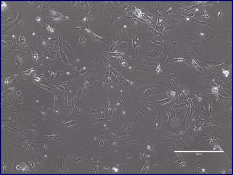 Mouse Embryonic Fibroblast Cells Bioinnovatise