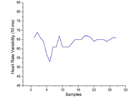 The Hrv With Error Data Removed Using The Proposed Random Error