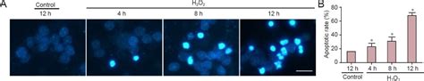 Neuroprotective Effects Of Ganoderma Lucidum Polysaccharides Against