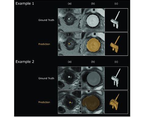 results of the auto segmentation network from two example patients and