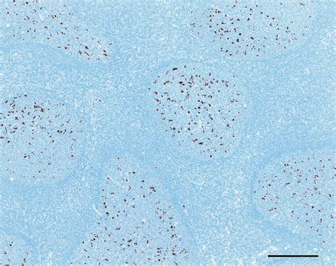 Ihc Detection Of Prp Sc In The Nictitating Membrane Lymphoid Tissue A