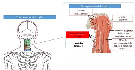 Músculo Multífido Cervical Dolopedia