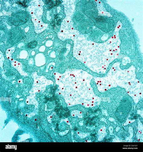 Colorized Transmission Electron Micrograph Of Yellow Fever Virus Particles Red Found Within
