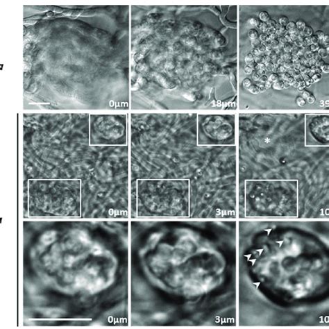 Botrytis Cinerea And Orbiliomycetes Arthrobotrys Oligospora Develop Download Scientific Diagram