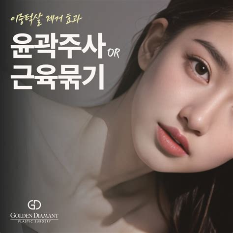 윤곽주사 Or 지방흡입 후 근육묶기 이중턱살 제거 효과 네이버 블로그