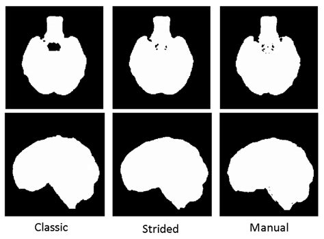 Left Example Segmentation Result Obtained Using Classic Patch