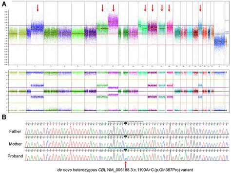 Embryonal Rhabdomyosarcoma In A Patient With A Germline Cbl Pathogenic Variant Abstract
