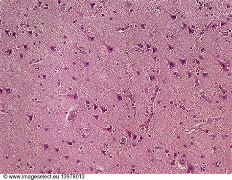 Pyramidal Cells In Human Cerebral Cortex Pyramidal Cells In Human Cerebral Cortex LM Brain