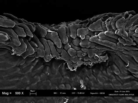 Can Anyone Help Me Is This A Juvenile Bivalve Or An Ostracod