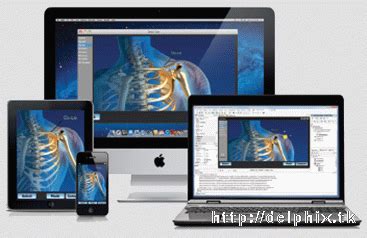 KeyGen для Delphi XE Все для Delphi