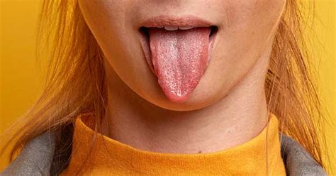 Lengua Sucia Amarilla Cambios De Color De La Lengua Y Otros Cambios