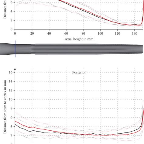Distance Between Stem And Cortex In The Anterior And Posterior Sector