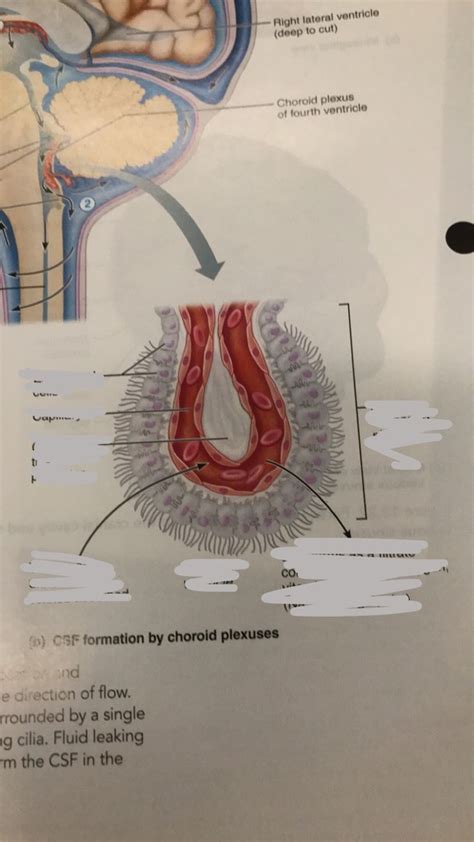 Csf Formation By The Choroid Plexuses Diagram Quizlet