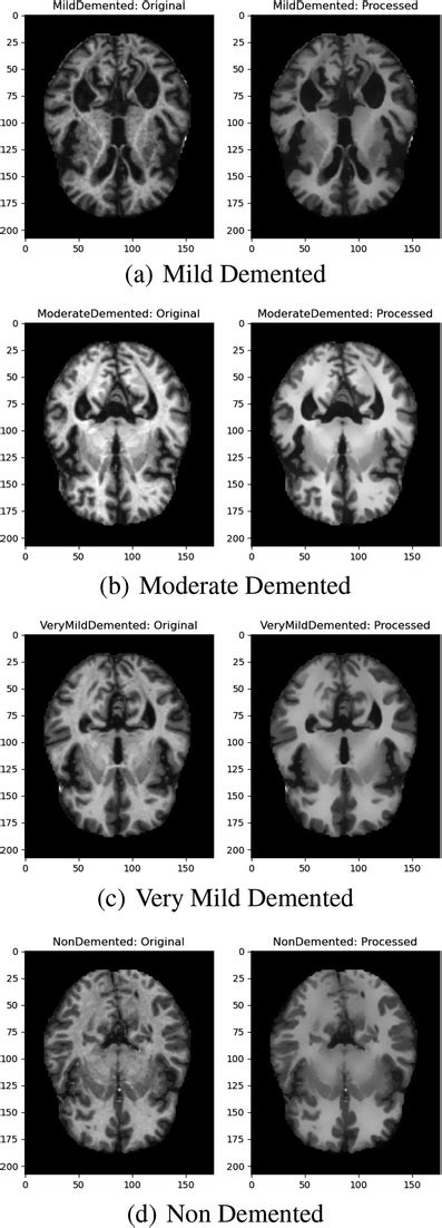 original vs pre‐processed images download scientific diagram
