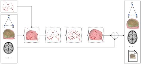 Pseudo‐mri Engine For Mri‐free Electromagnetic Source Imaging Megin