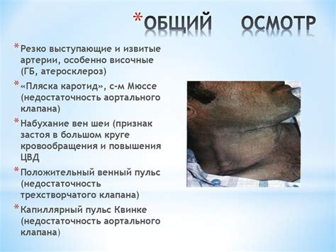 Методы исследования при заболеваниях органов кровообращения презентация онлайн