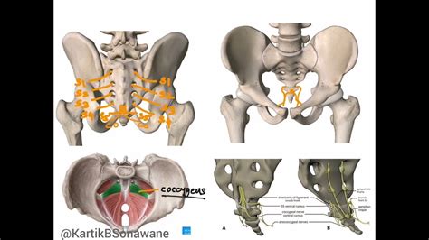 How To Draw Coccygeal Plexus Youtube