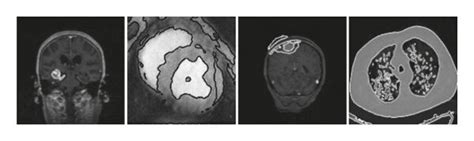 Segmentation Results Of Medical Images A The Segmentation Results Of